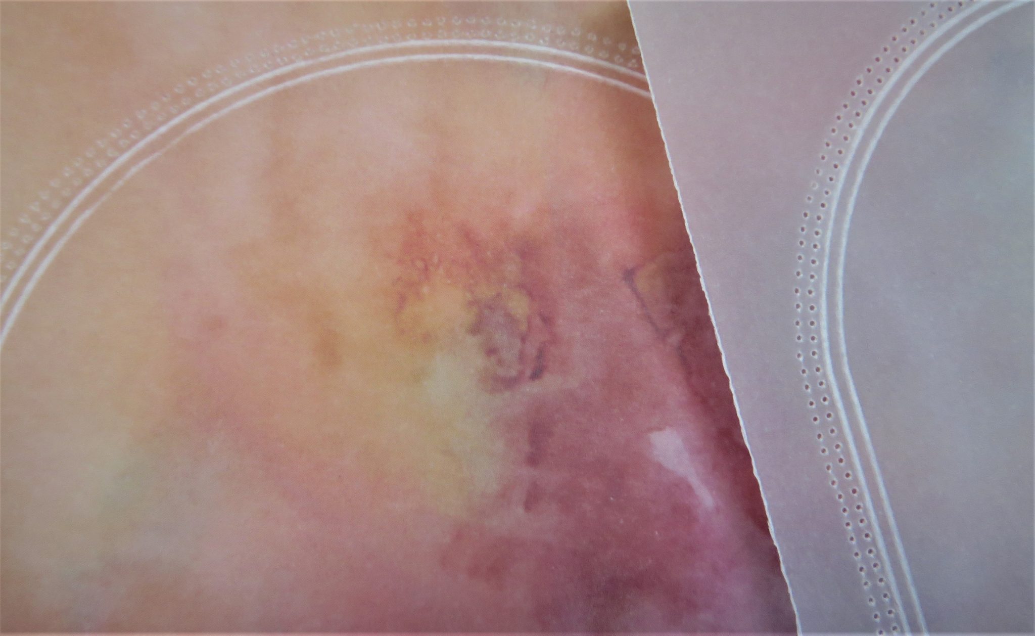 Clarity’s Blog Tutorial: How to 4 NEEDLE TOOL (Part 1)